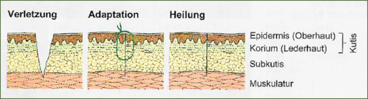 Abschlussarbeit Pflege Januar 2024 - BzG Bildungszentrum Gesundheit ...